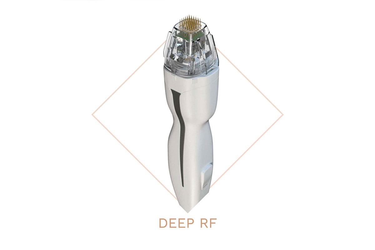 Virtue RF Microneedling in Waxhaw, NC | Renew Med Spa
